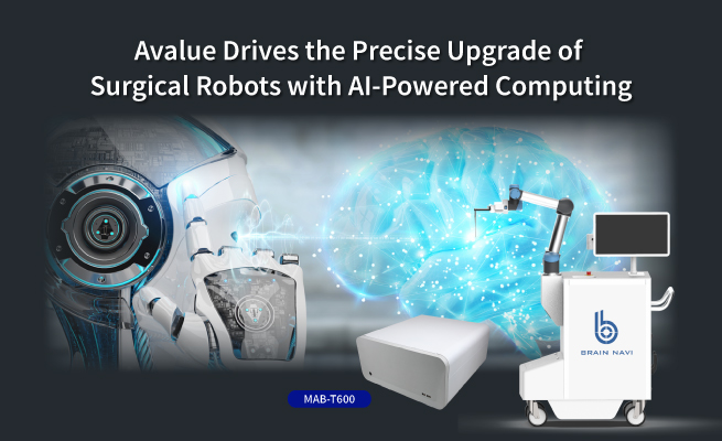 手術ロボットの精密性と効率を飛躍的に向上-支えるのはAvalueのAIパワー - Avalue ジャパン